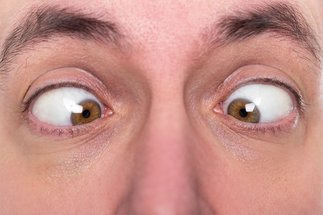 ¿Cuales son las causas del estrabismo? - Usted Pregunta